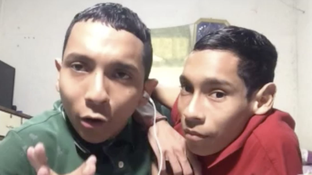 La increíble historia de los siameses que hace 21 años comparten ...