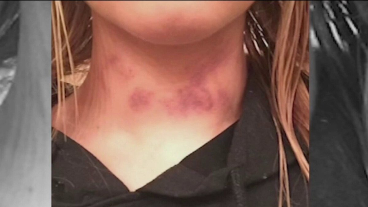 Abogado Revela Imágenes De Supuesta Víctima De Violación Sexual