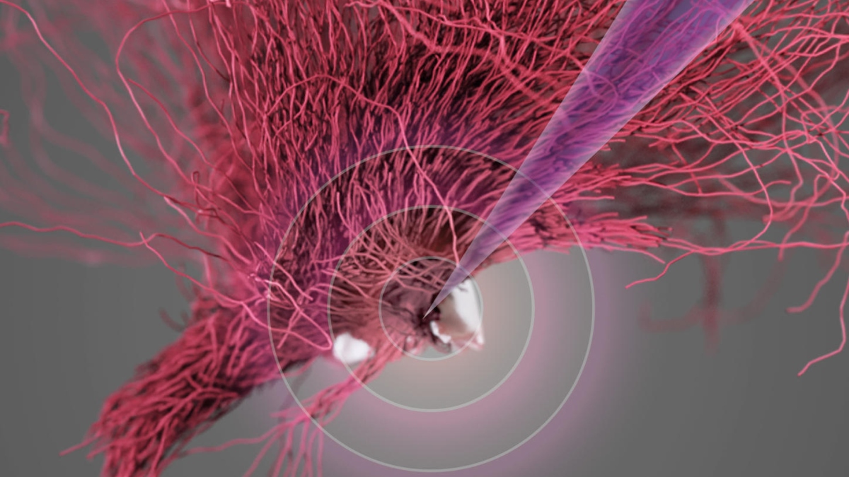 Suiza: personas con lesión medular vuelven a moverse y caminar ...